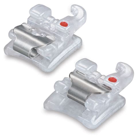 Ceramic Self Ligating Braces At Robert Bullock Blog