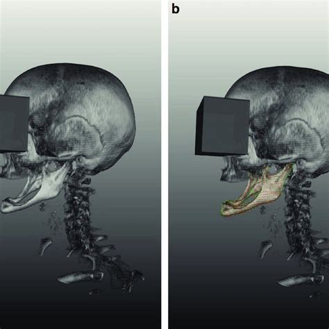 3d Image Data Reconstruction Each Ct Image Scan Consists Of Multiple Download Scientific