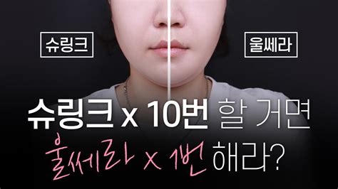 슈링크 10번 Vs 울쎄라 1번 직접 해보고 정답 알려드립니다 Youtube