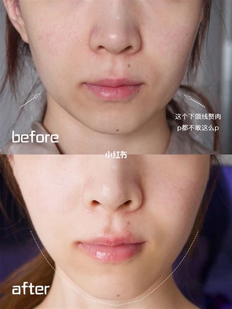 涂出胶原蛋白纤雕精华效果跟换了个头似的 最近经常整理手机相册看到前几年的照片，我就经常感叹，胶原蛋白真的好重要，好显嫩哦！看完之后就跟打鸡