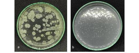 Colonies Of Bacteria On Tryptic Soy Agar Agar Bacteria