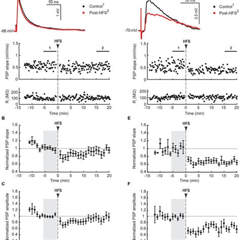 Ipsilateral Ac And Contralateral Df Cortical High Frequency