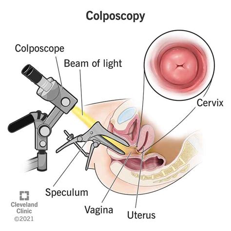 Colposcopy Business Plan Template
