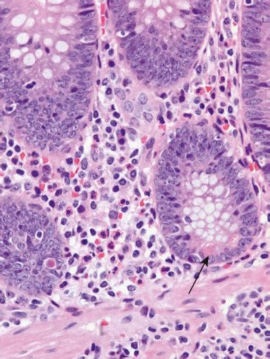Appendix Clinical Tree