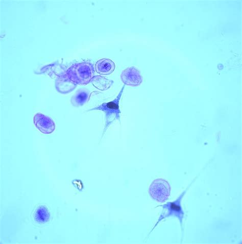 Mshernandezscience [licensed For Non Commercial Use Only] Protist