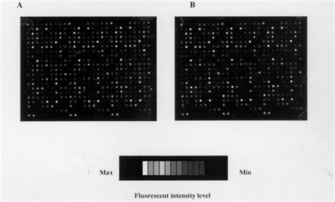 Breast Cancer Microarray Hybridized With Cdna Derived From Mrna