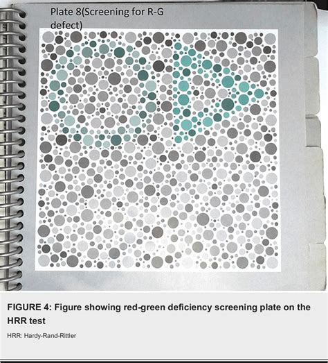 Figure From The Prevalence Of Congenital Color Vision Abnormality Among Patients Attending A