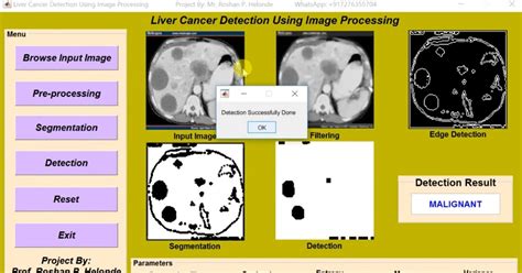 Matlab Code For Liver Cancer Detection Using Image Processing Full Project Source Code