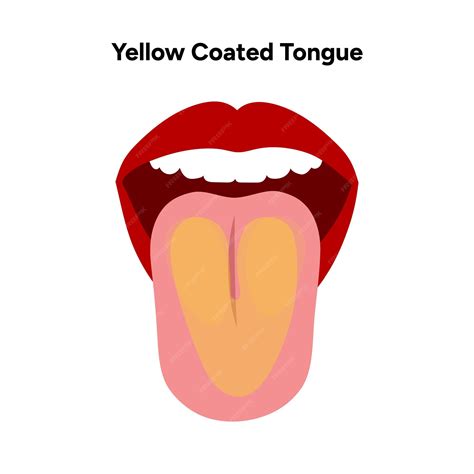 Premium Vector Yellow Coated Tongue