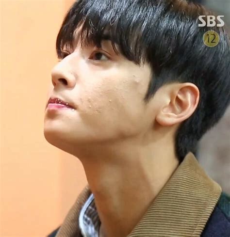 차은우 여드름성 피부 Mlbpark