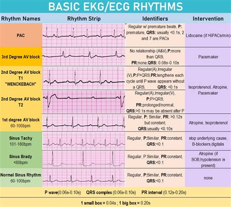 Ecg Rhythms And Intervention Etsy