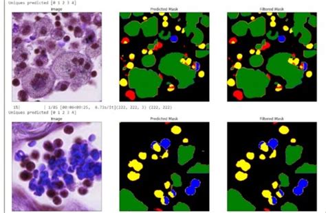 Github Aadesh 1404nuclei Segmentation Classification