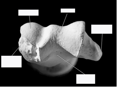 Right Humerus Distal Diagram Quizlet