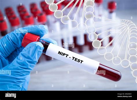 Noninvasive Prenatal Testing Nipt Nurse Holding Test Tube With Blood