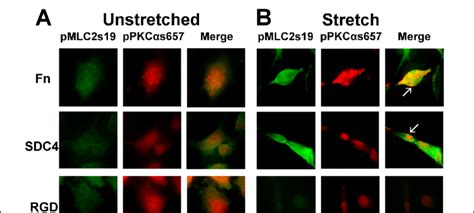 Myosin Light Chain Kinase Phosphorylation Antibody Shelly Lighting