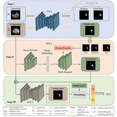 aslseg adapting sam in the loop for semi supervised liver tumor segmentation ai research
