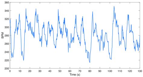 Initial Heart Rate Estimation Without Adaptive Filtering Download Scientific Diagram