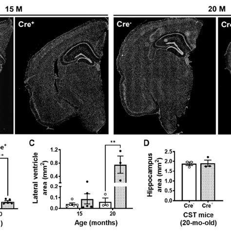 Apoe Isoform Dependent Sulfatide Deficiency And Brain Ventricular Download Scientific Diagram