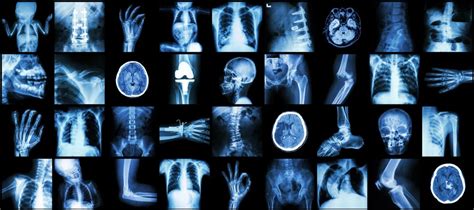 How To Convert Grayscale Dicom File To Rgb Dicom File With Python By