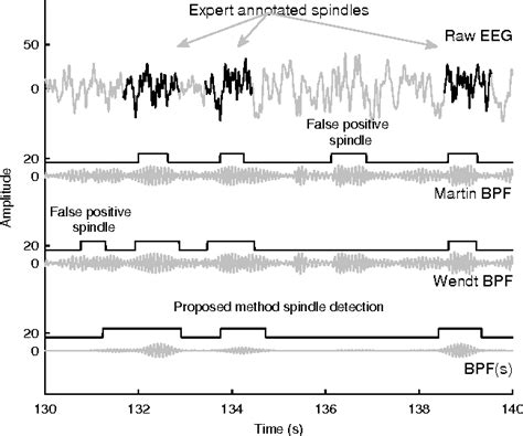 Figure 1 From Detection Of K Complexes And Sleep Spindles Detoks Using Sparse Optimization