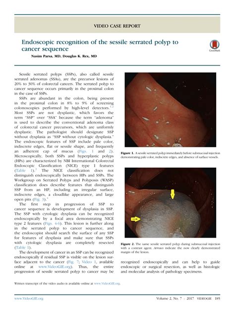 Pdf Endoscopic Recognition Of The Sessile Serrated Polyp To Cancer