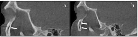 Unilocular A And Multilocular B Zbp Arrows Download Scientific Diagram