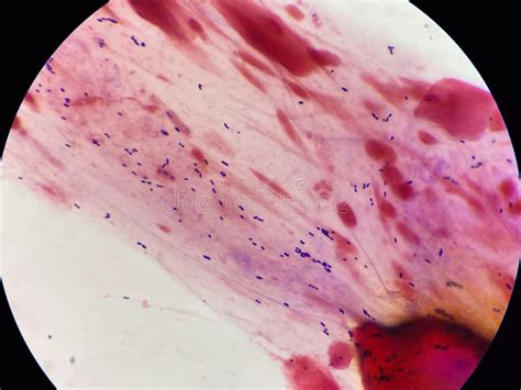 Gram Positive Bacilli In Sputum Stock Image Image Of Bacterium