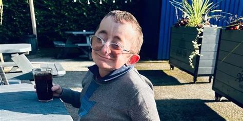 Benjamin Button Teen Mistaken For Middle Aged Man Due To Rare Genetic Condition Somerset Live