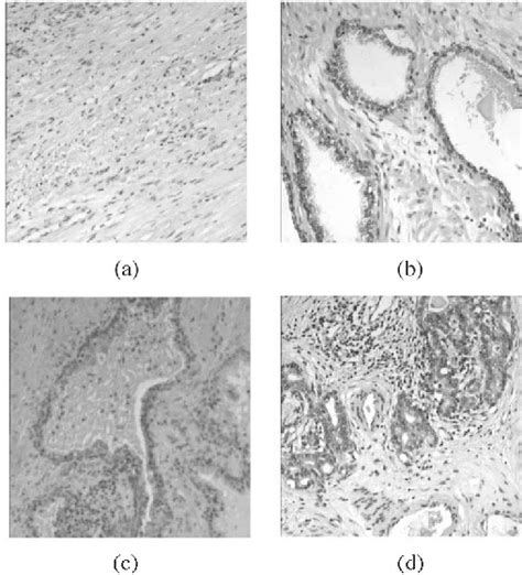 Figure 1 From Novel Round Robin Tabu Search Algorithm For Prostate Cancer Classification And