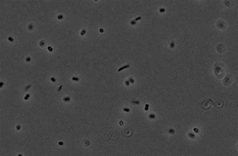 Detection Bacter Gray New Object Detection Dataset By Maxim