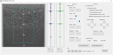Telemed Ultrasound Home