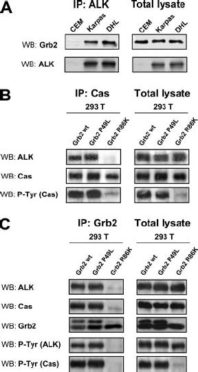 Npm Alk Binds P130cas Through The Sh2 Domain Of Grb2 A Npm Alk Binds