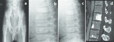 Skeletal Radiographic Survey And Computed Tomography Ct Download Scientific Diagram