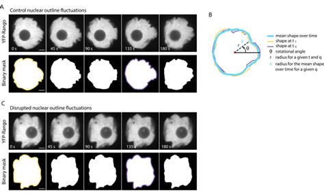 Capturing Cytoskeleton Based Agitation Of The Mouse Oocyte Nucleus Across Spatial Scales
