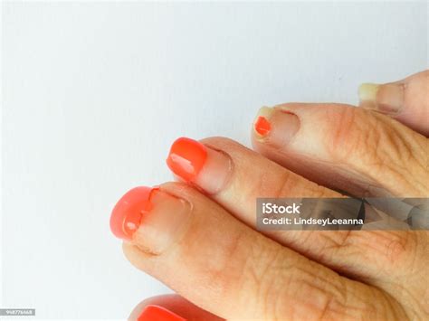 심하게 못생긴 여자의 발 긴 연어 색된 발톱을 신랑 페디큐어가 필요 합니다 연체 페디큐어입니다 흰색 배경에 고립 건강관리와 의술에 대한 스톡 사진 및 기타 이미지 Istock