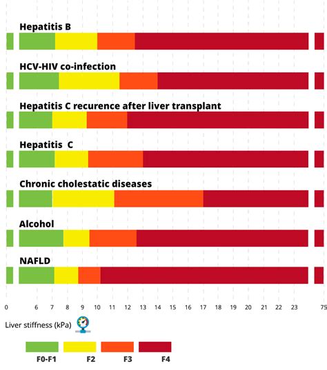 Fibroscan Cirrhosis Care