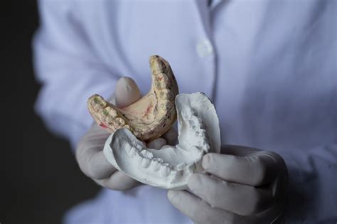 연구 진단 캐스트 및 치과 실험실에서 치과 석고 모델의 캐스팅 개념에 대한 스톡 사진 및 기타 이미지 개념 건강 진단