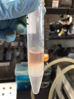 Is A Milky Consistency Required For Mixture Before Centrifuge During Extraction Of Metabolite In