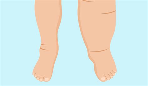 Endocrinologist Who Is Endocrinology And Different Kinds Healthsimply