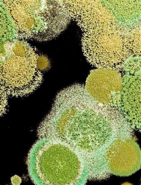 Почему мы неправильно используем Триходерму и она не помогает от хворей на огороде 3 причины