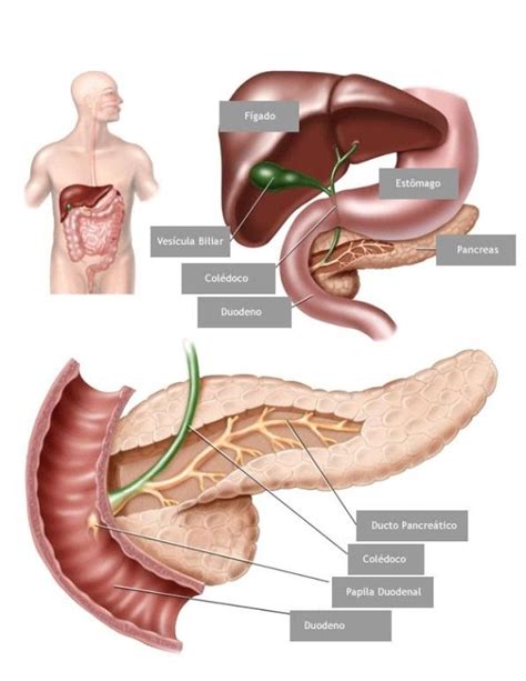 Tudo O Que Precisa Saber Sobre Tratamento Da Pancreatite Crônica