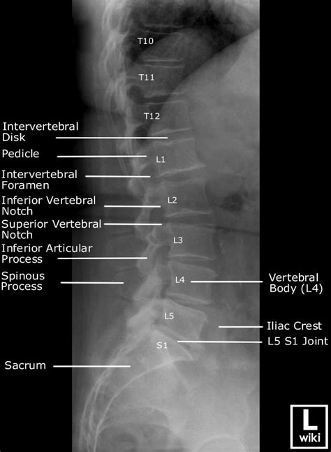 Pin On Radiography