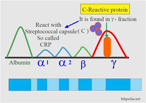 Chapter 31 Common Serological Test Antistreptolysin O Aso C Reactive Protein Crp Chapter 31 Common Serological Test Antistreptolysin O Aso C Reactive Protein Crp