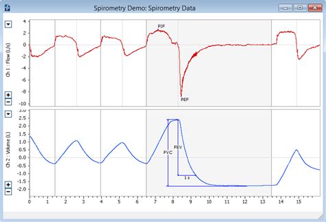 Spirometry Graph Analysis Respiratory Software Adinstruments