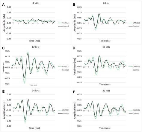 Abr Waveforms At 80 Db Averaged Across Untreated Samp8 Mice Black Download Scientific Diagram