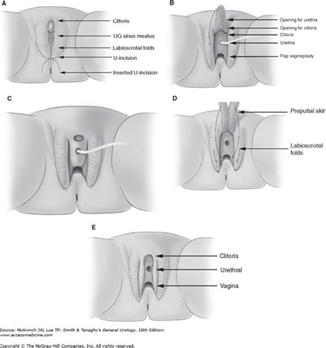 M Mcan18 C043f027 Png Abdominal Key