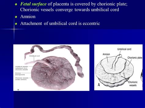 Fetal Membranes And Placenta Ppt Video Online Download