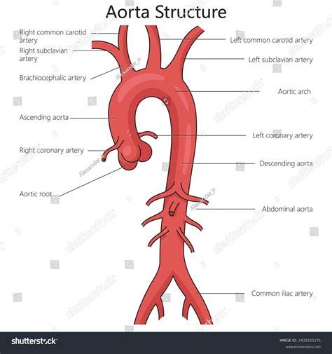 Aortic Bifurcation Anatomy Aortic Dissection 4 Drsvenkatesan Md