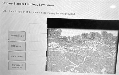 Urinary Bladder Histology Low Power Label The Micrograph Of The Urinary Bladder Using The Hints