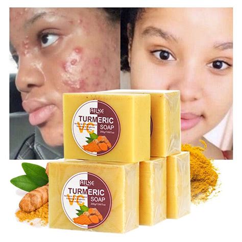Turmeric Acne Soap Cosmetics Store